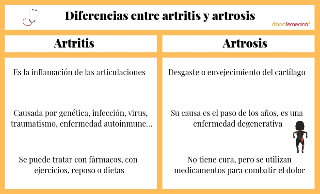 Artritis y artrosis no es lo mismo: conoce las diferencias Artritis y artrosis no es lo mismo: conoce las diferencias